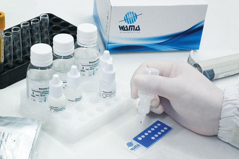 HEP2 IMUNOFLORESCENCIA 100 TESTES WAMA - Centerlab - Central de Artigos ...
